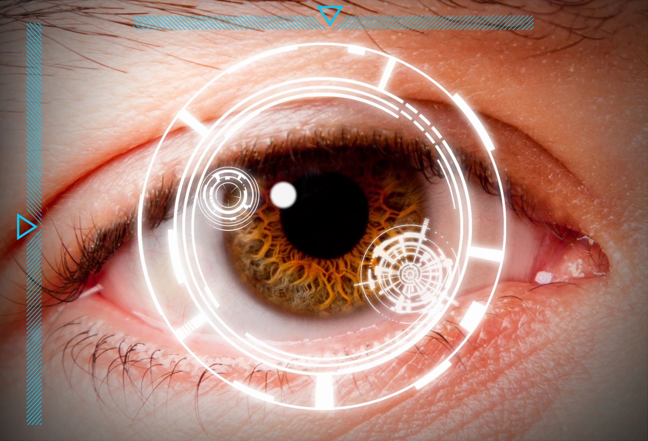Hemianopia Help Hemianopia Visual Field Loss