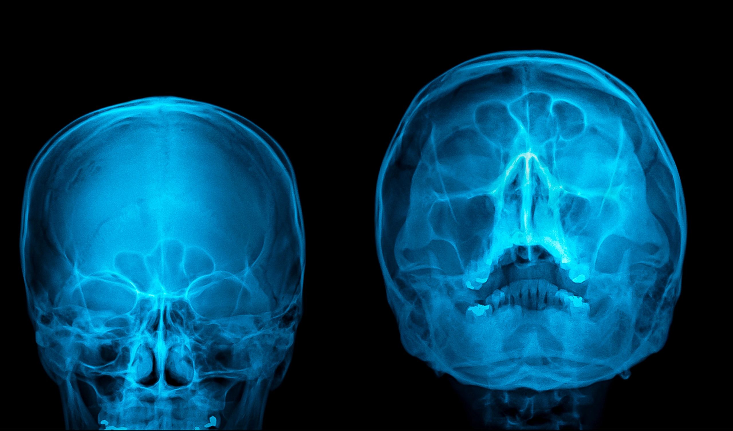 Expert Trauma Education Resources