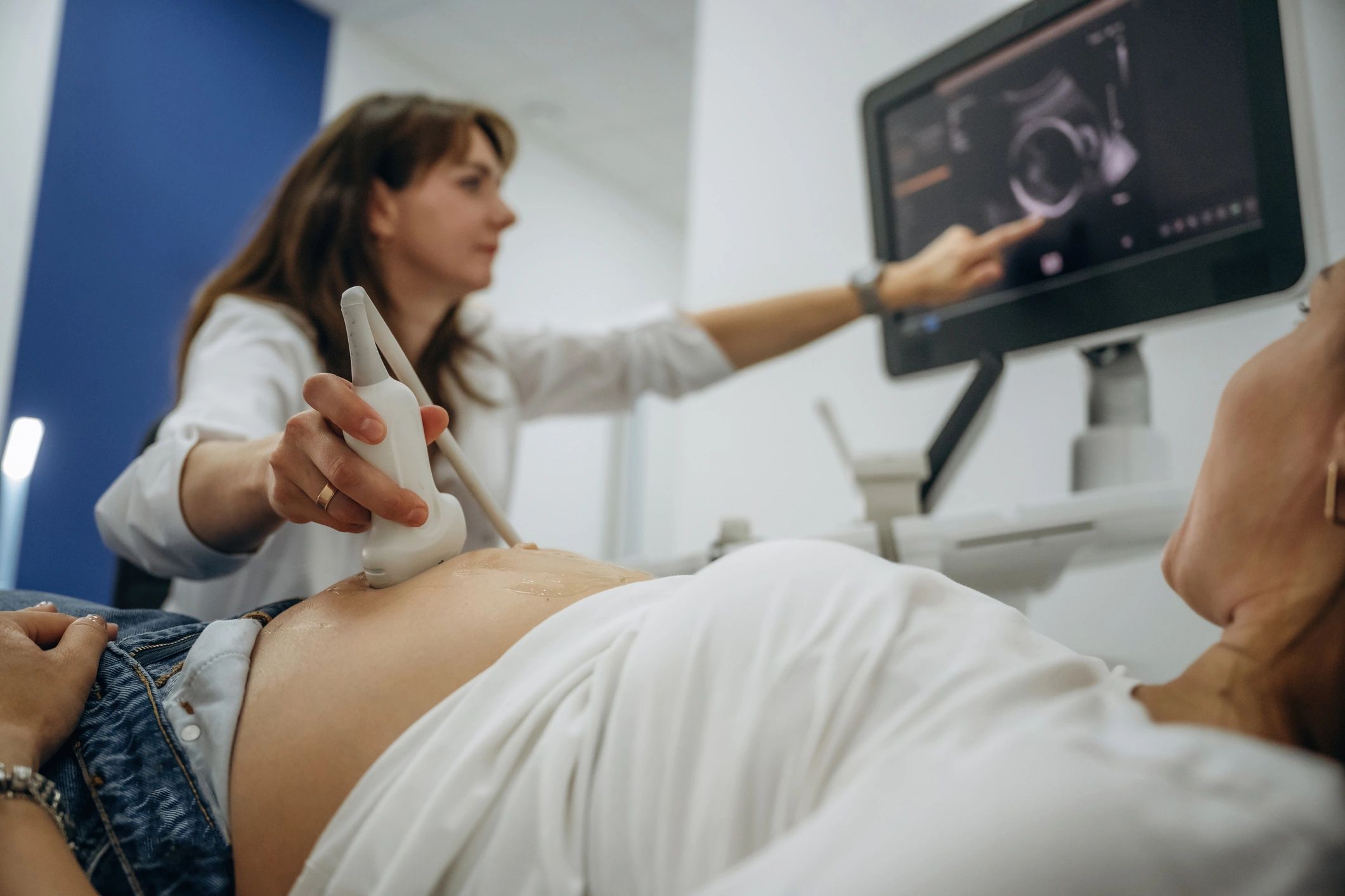 Advanced Ultrasound Units for Accurate Diagnosis