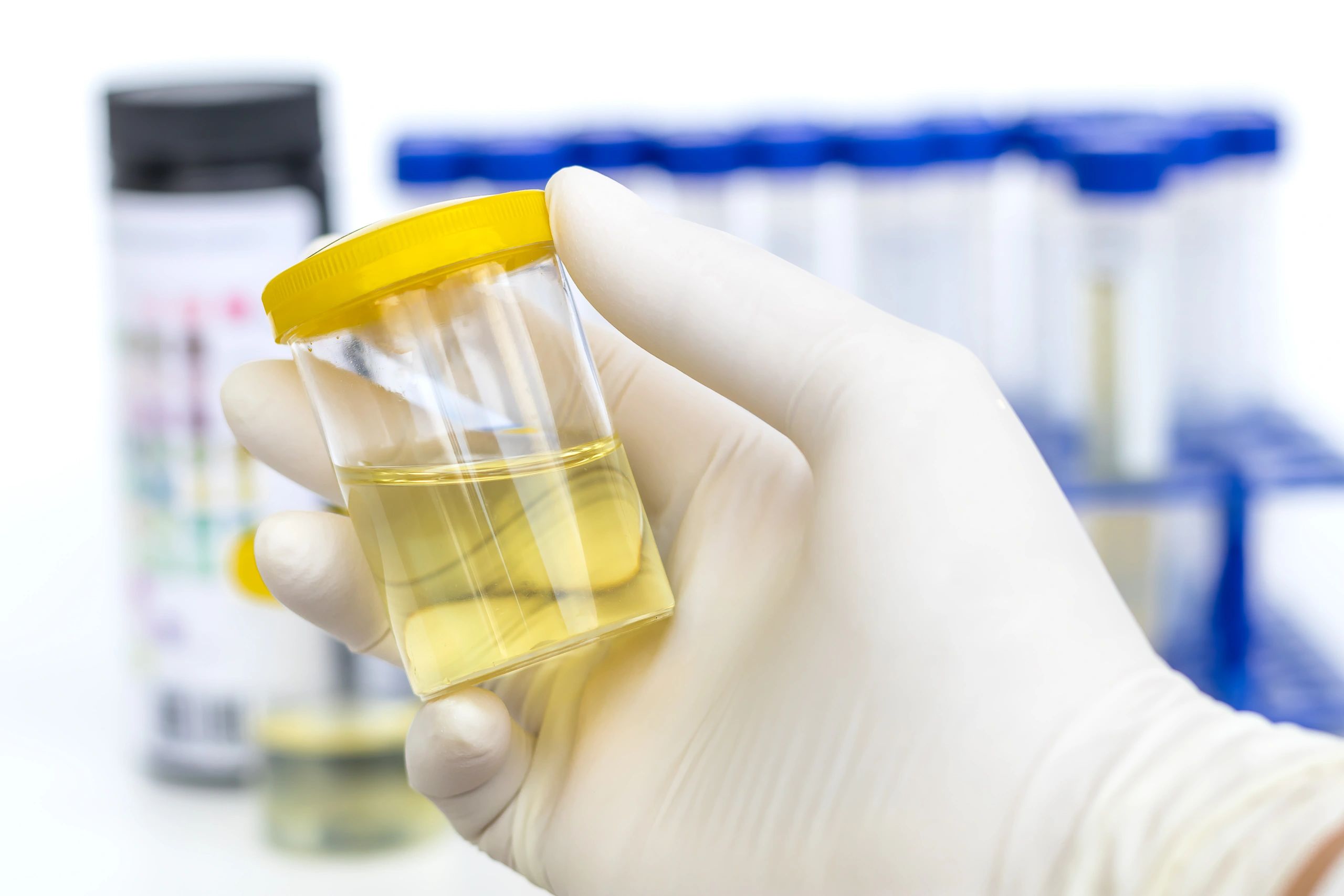 PRECISION TEST LAB - Dot/Non Dot Drug Testing, Dna Testing Near Me, Dna ...