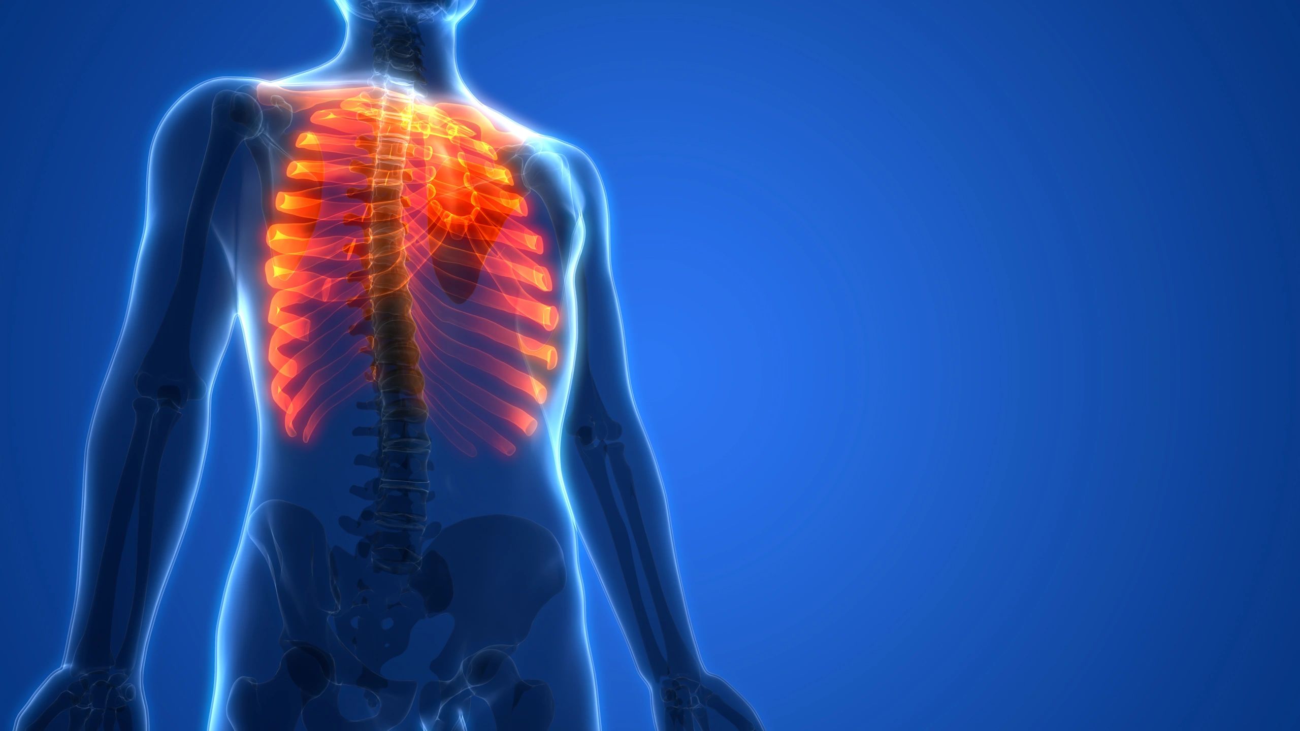 costochondritis.org