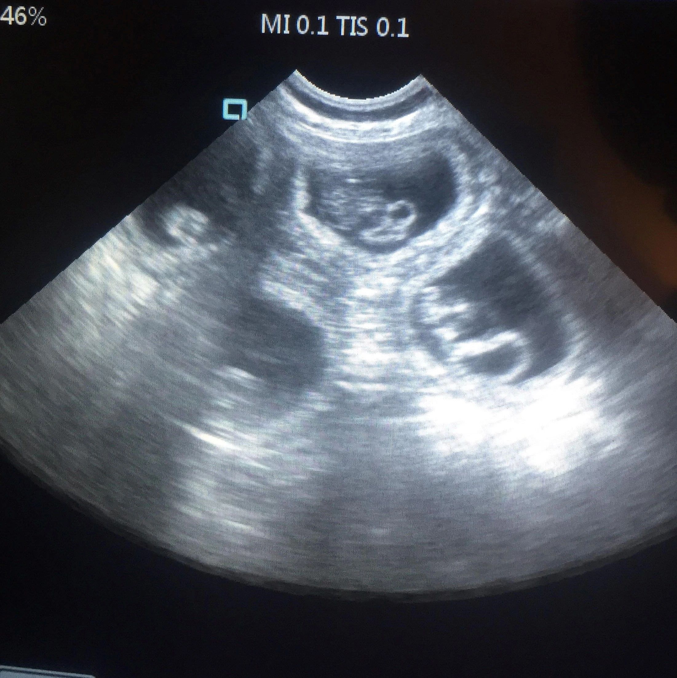 Pregnant Dog Ultrasound