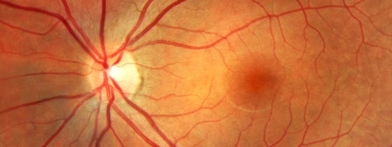 The Retina Reading Center