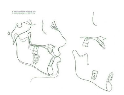 Ceph Tracing - Cephanalysis.com