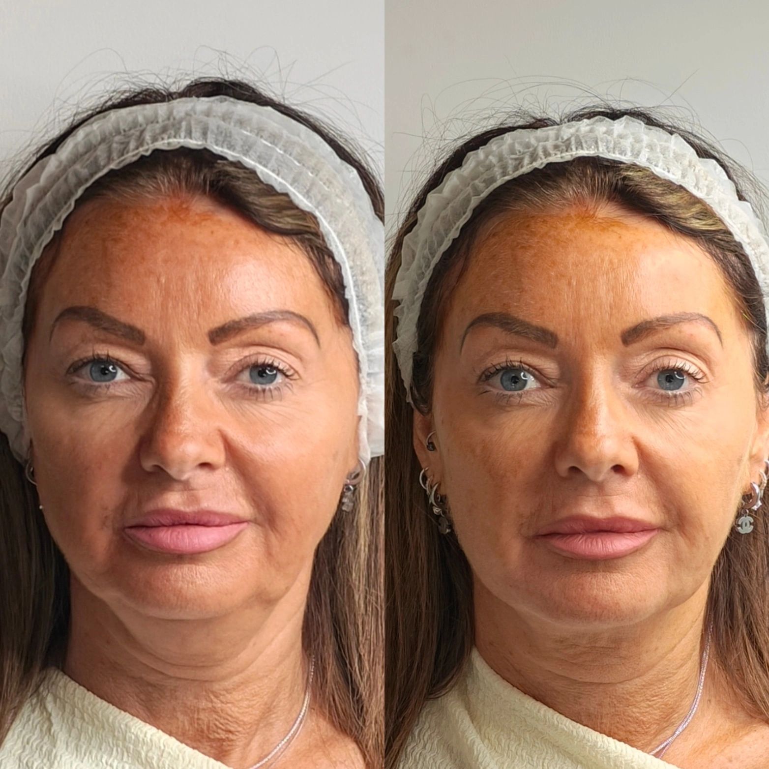 PDO Cog Thread Lift ⚙️