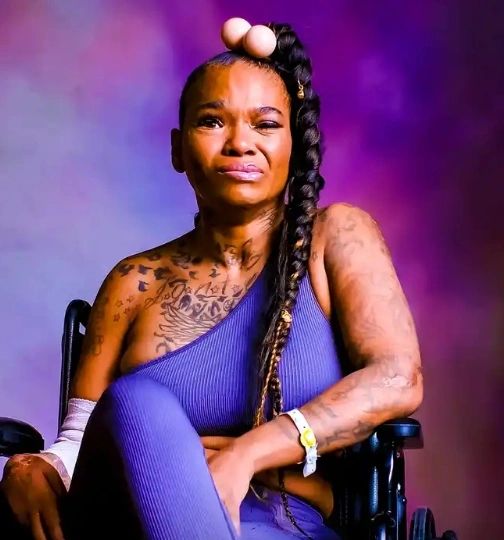 Former Stripper Apple Watts Reflects on Life-Changing Crash