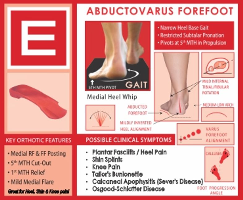 Quadra Step Foot Types | ArchMasters