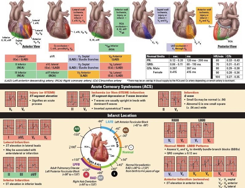 ECG Quick Reference