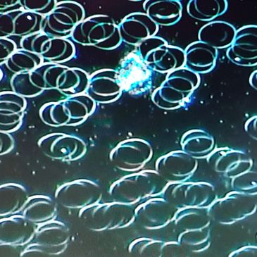 Live blood analysis, nutritional microscopy - Assure Health and ...