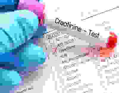 Dosing and Monitoring | Gentamicin Information Center