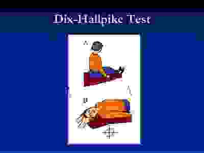 Vestibular Testing/Rehab | Gentamicin Information Center