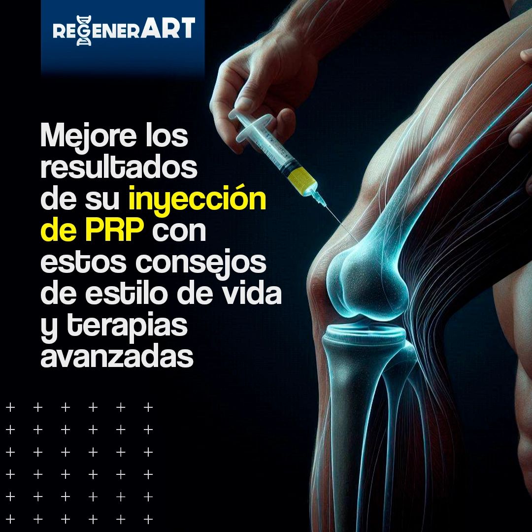 ¿Cómo podemos mejorar el resultado del PRP?