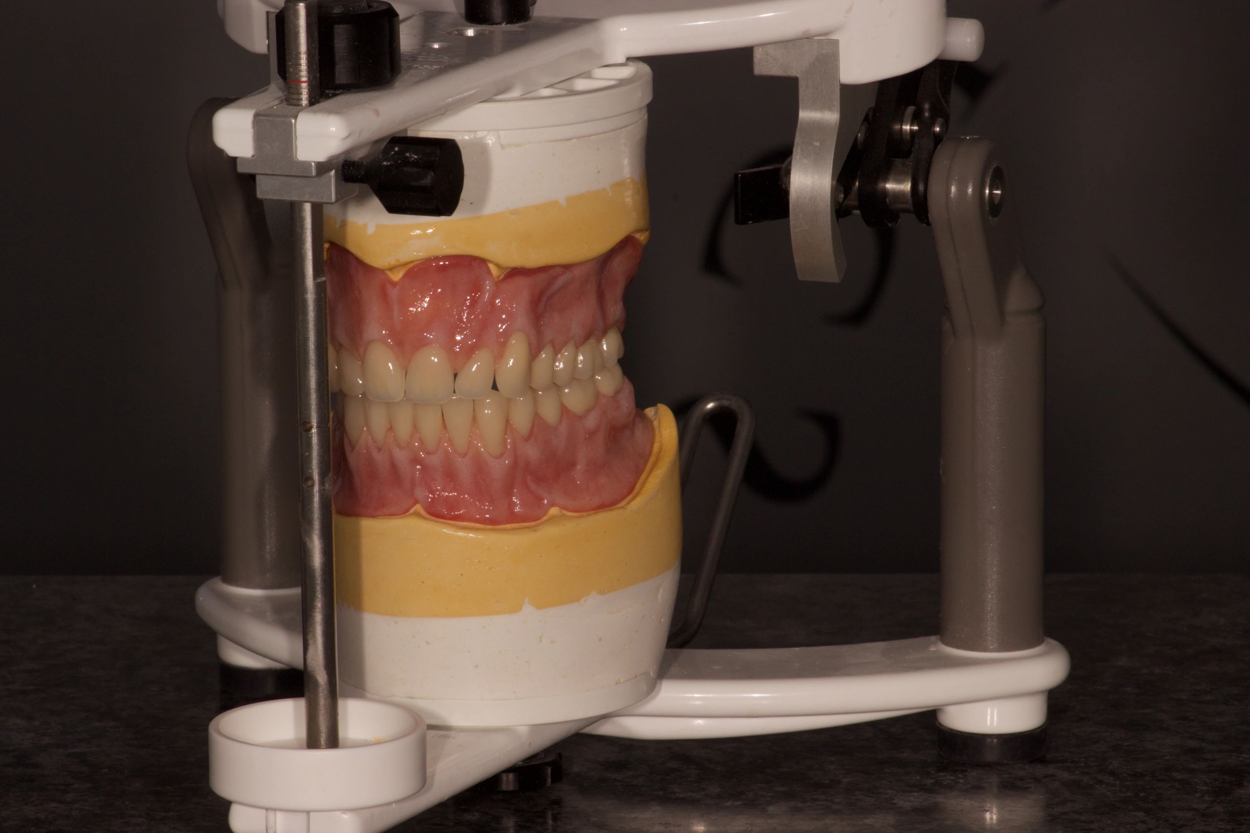 Dentures | Denturamics