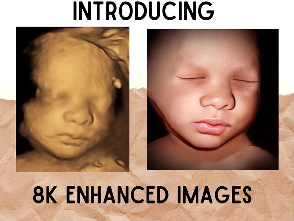 Peek A Boo Baby, LLC - Baby Ultrasound, 3D and 4D Ultrasounds