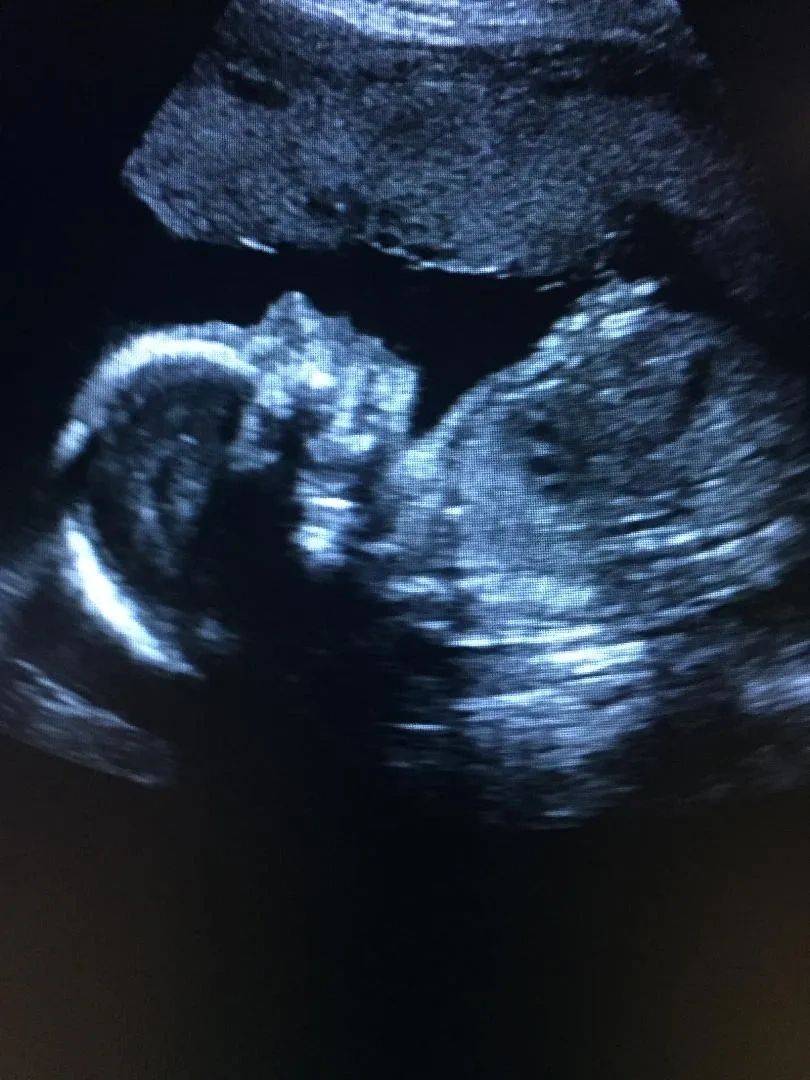 Peek A Boo Baby, LLC - Baby Ultrasound, 3D and 4D Ultrasounds