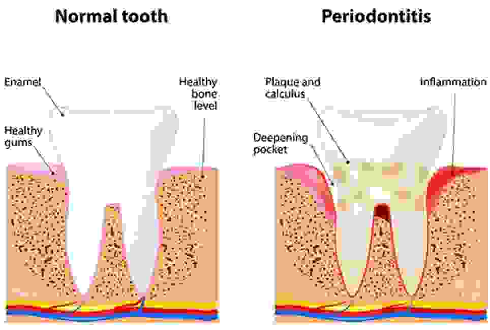 GC Perio - Periodontist, Dental Implants, Gum Disease, Receding Gums ...