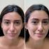 Permanent Makeup Clinic in Largo Florida - Impressive Brows