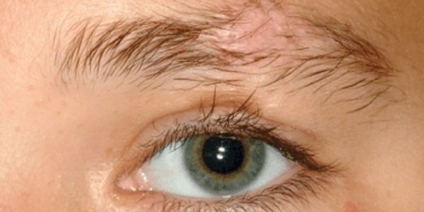 Impressive Brows - Permanent Makeup, Eyebrow Microblading