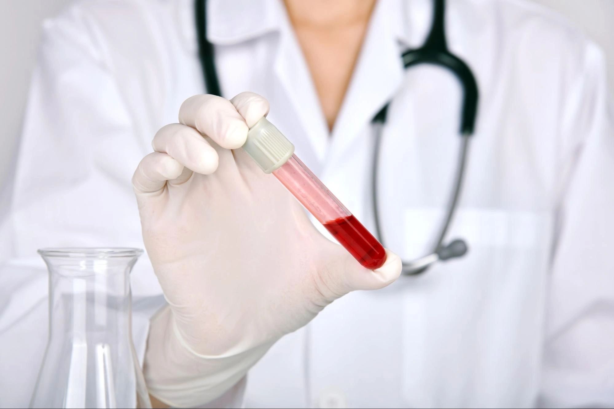 Most Common Types of Blood Tests