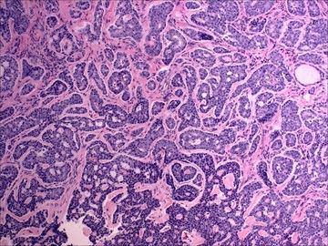 FDA update on Pathology peer review Q & A