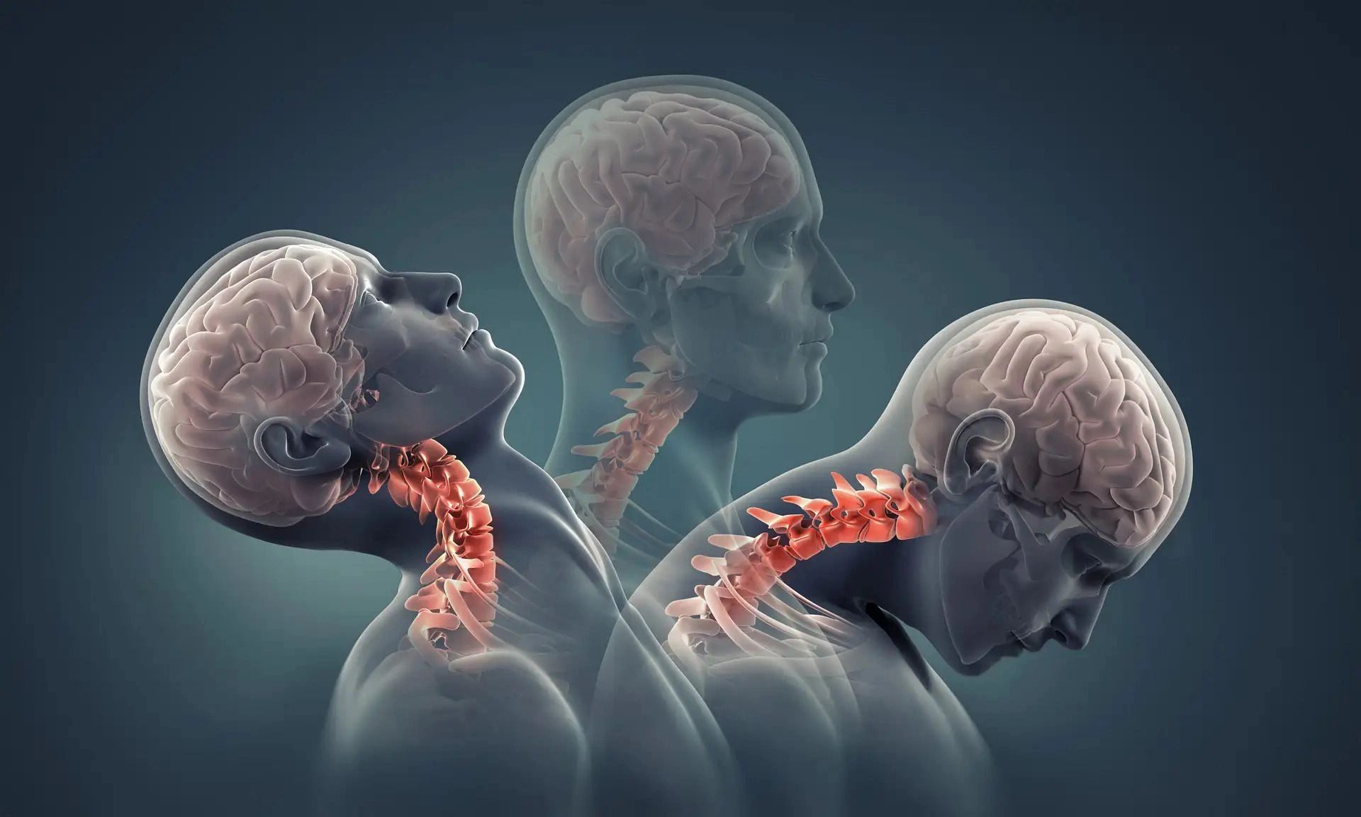 Neck Pain Cervical Instability Chiropractic El Paso