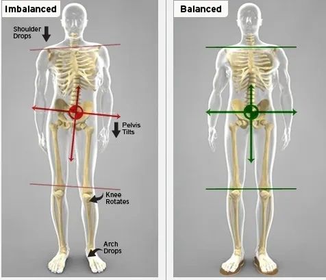 Chiropractic Care for Hip & Pelvic Misalignment from Car Crashes