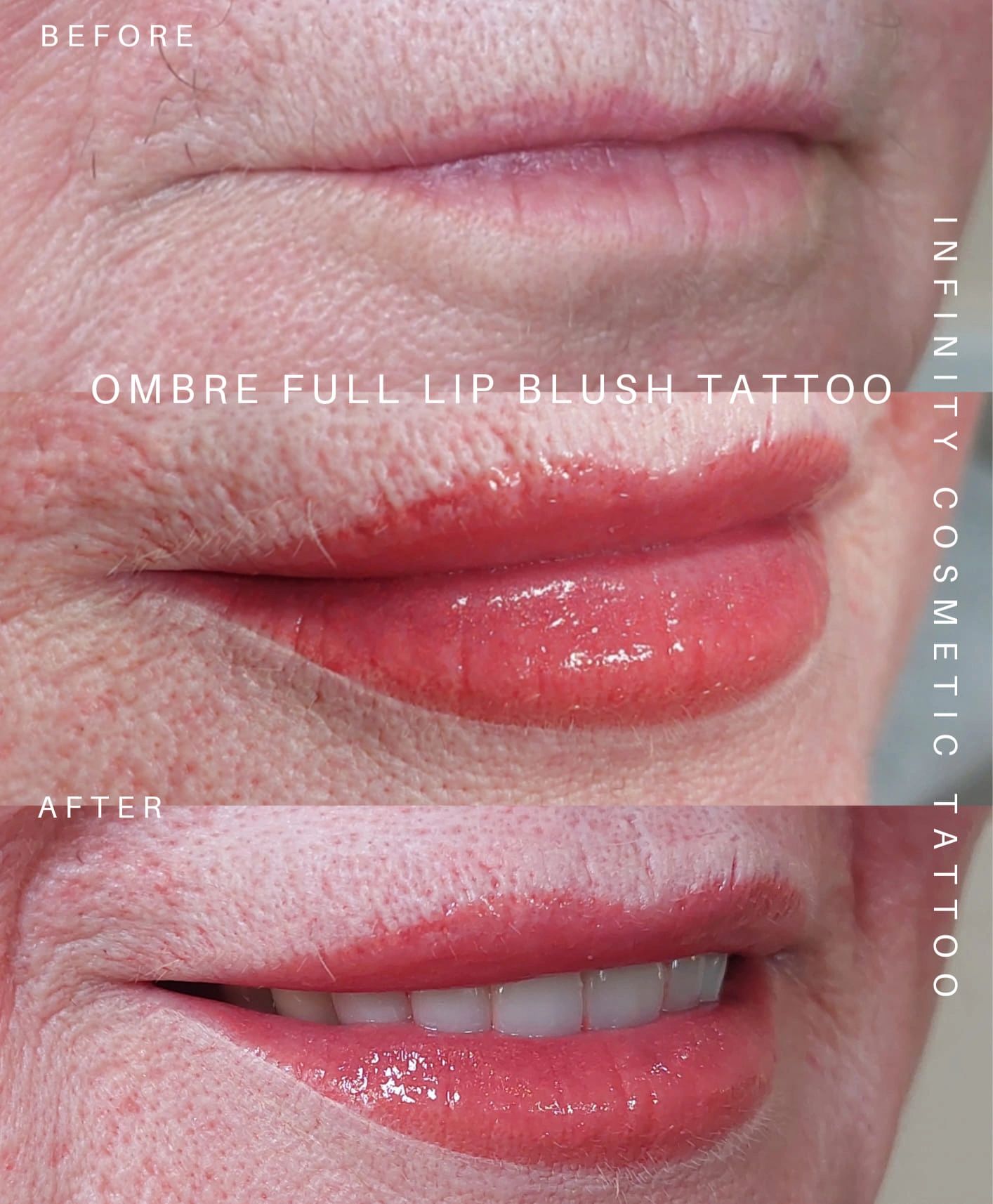 Lip Blushing on Mature Lips in Gold Coast : Enhancing Your Smile