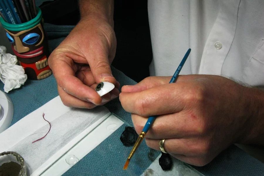 Scleral Shell Prosthesis