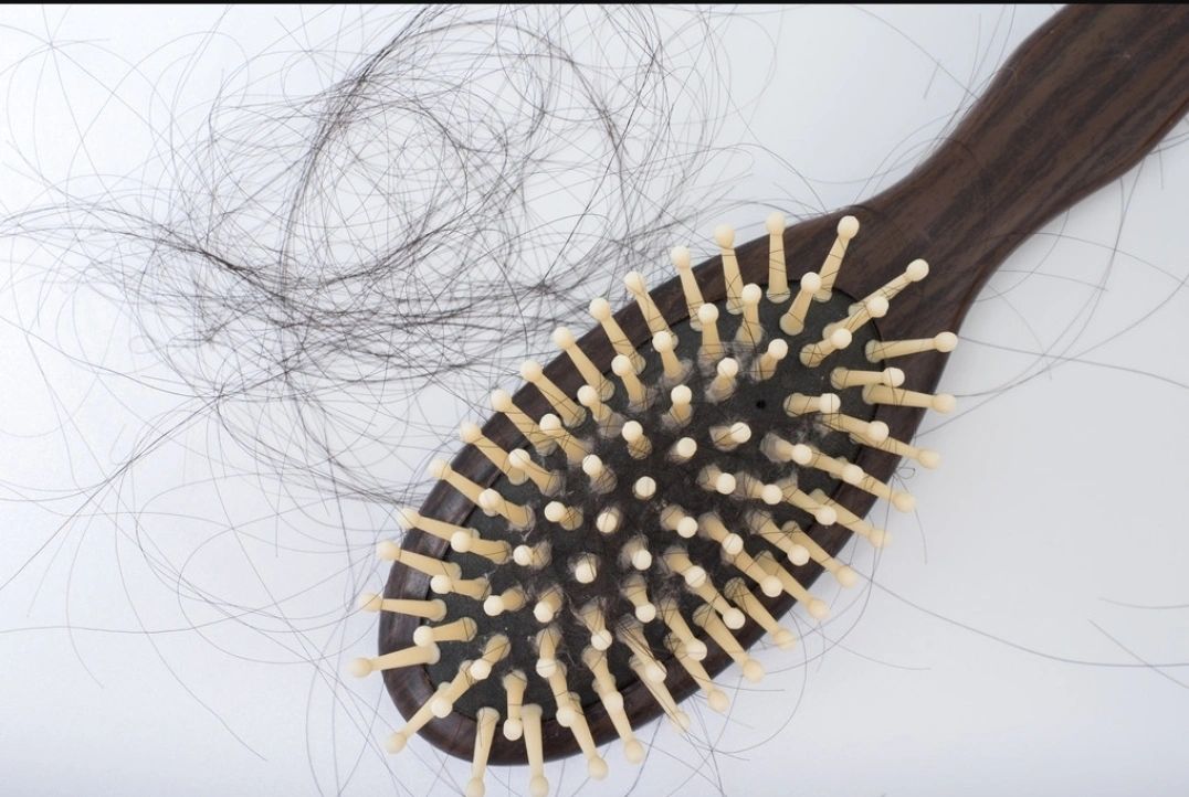 Loss of Strands Hair Restoration - Hair Loss Treatments, Trichology