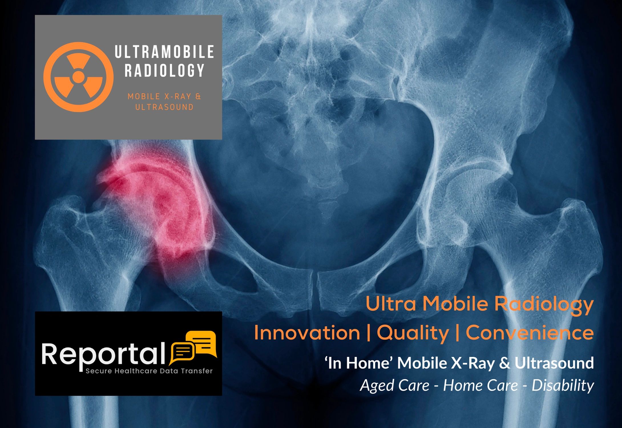 Mobile X-Ray and Ultrasound - Ultra Mobile Radiology