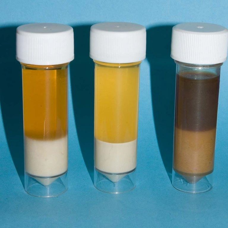 Rabbit urinalysis