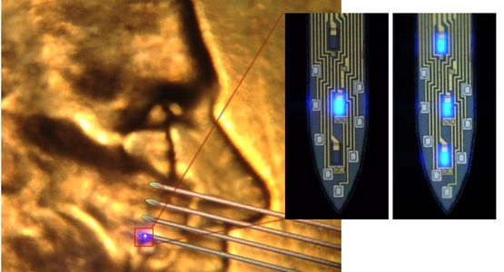 NeuroLight Technologies