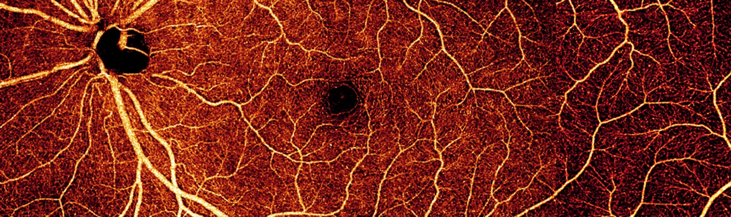 Scientific Research - International Ocular Circulation Society