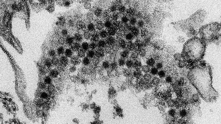 New method of fishing for viruses may have nailed what causes AFM