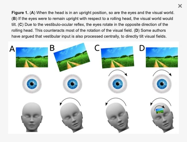 Understanding VOR (vestibular- ocular reflex)