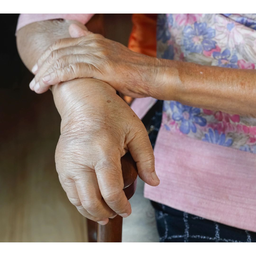 Overcoming Painful Hand After Stroke