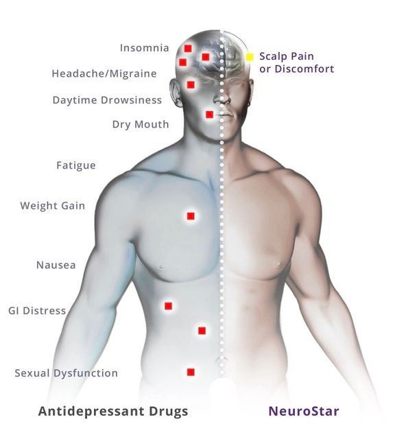 TMS Therapy | Midlothian Behavioral Health Associates