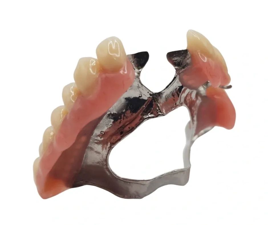 Chrome dentures - commonly asked questions