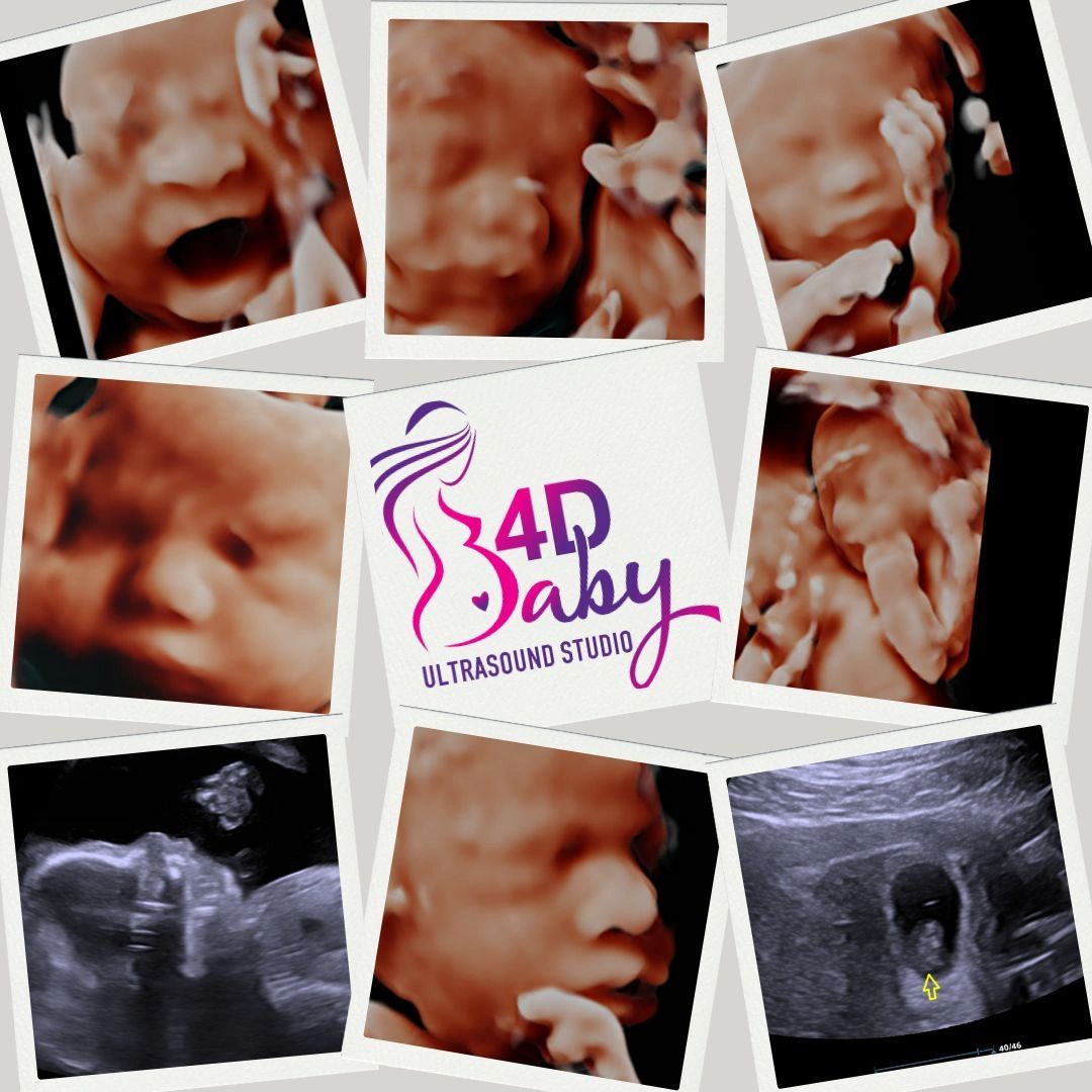 Experience Stunning 4D Ultrasound
