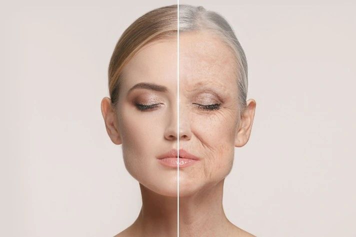 The Aging Process of the Lower Face