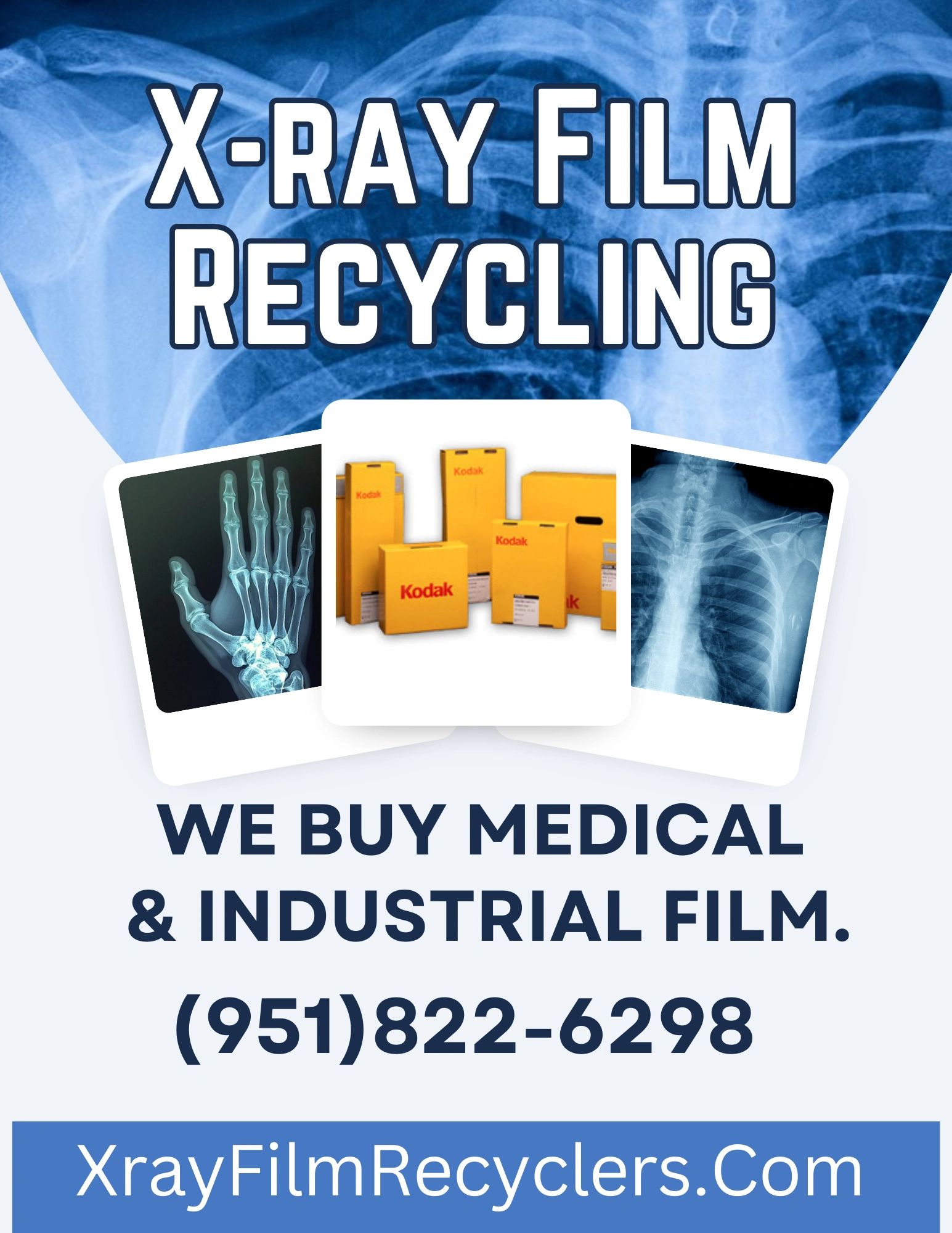X-ray Film Recycling In Ventura County: Recycle NDT Litho Film