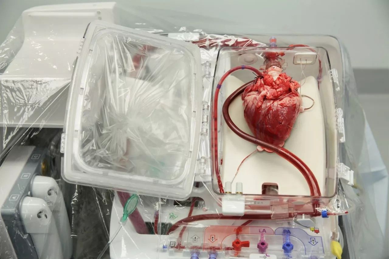 Warm Blood Perfusion System