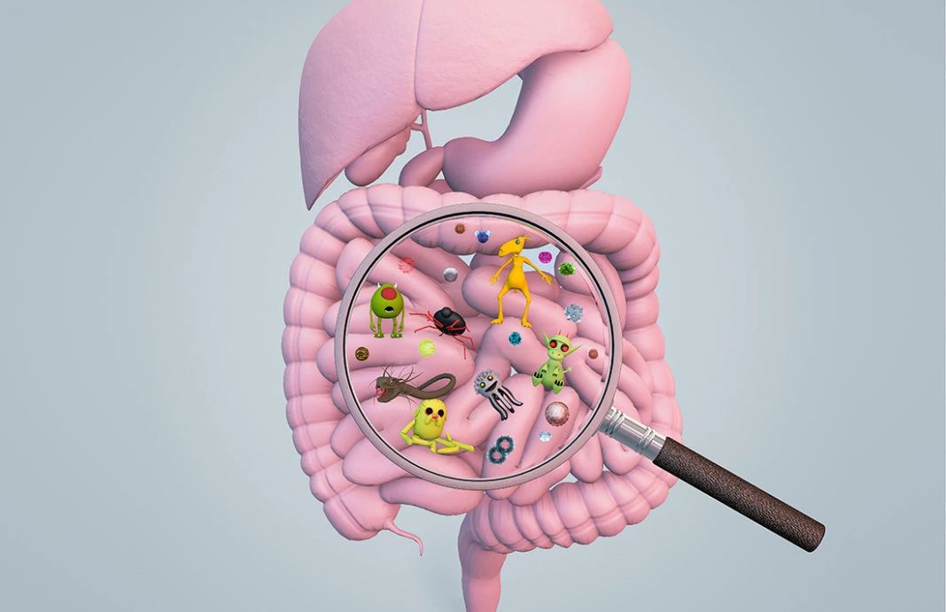 The Gut-Joint Connection