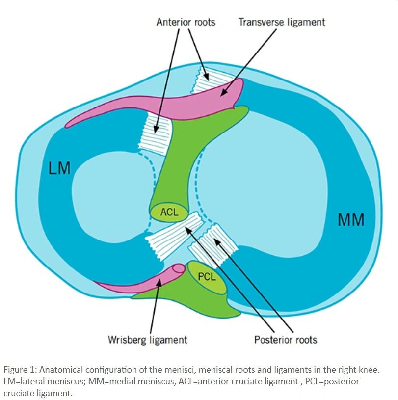 Meniscal Root Tear- Repair shown to delay arthritis progression