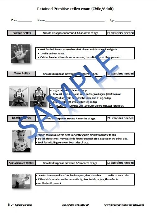 Retained Primitive Reflex Exam form