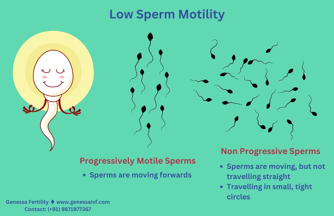 Low sperm motility - causes and treatment