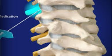 Neuro Sciences Centers - Pain Management, Pain Treament | Neuro ...