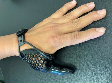 Partialhandsolutions - Prosthetic Finger, Partial Hand