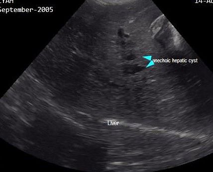 An Adrenal Mass in a Dog
