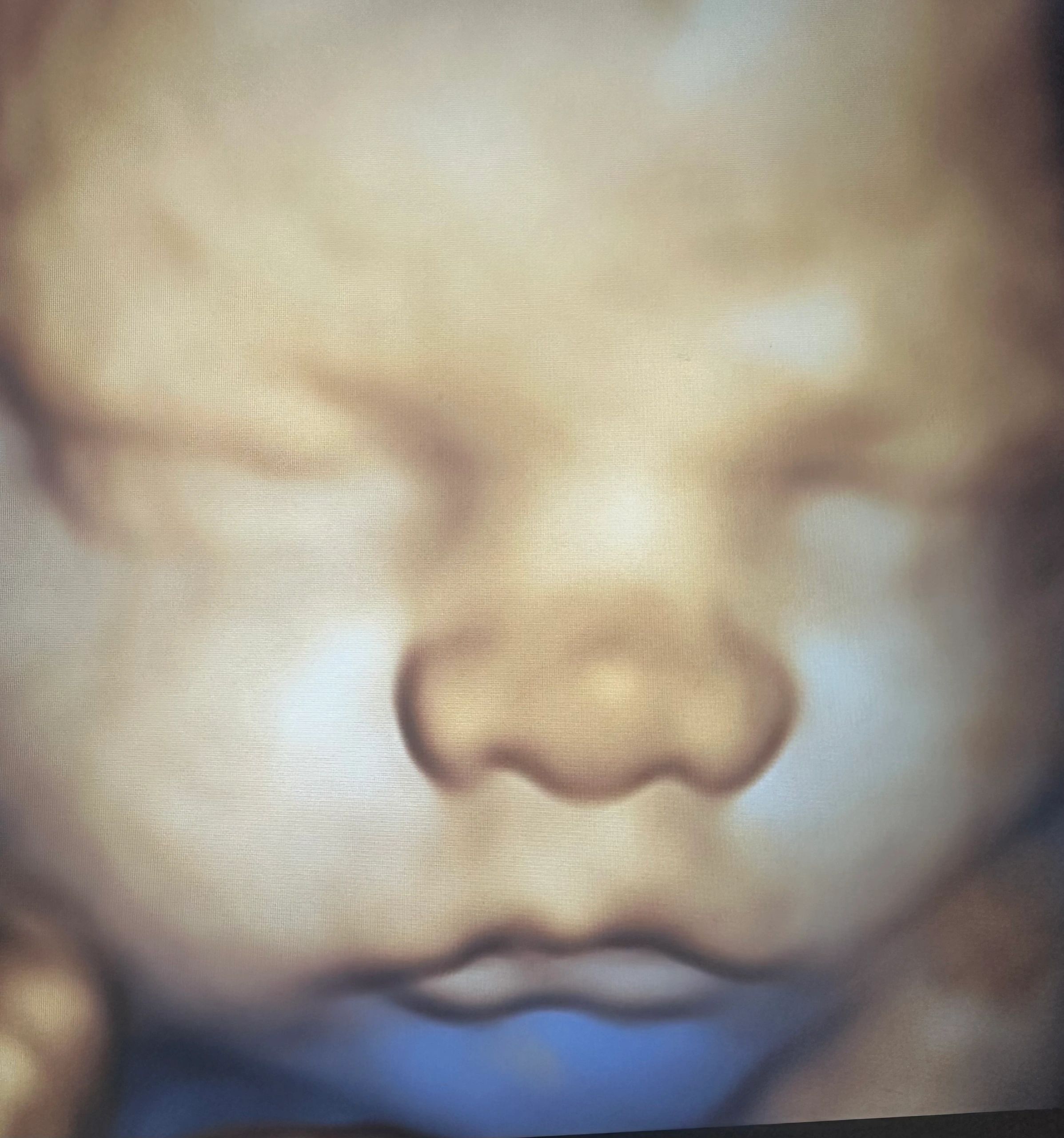 3d/ 4D Baby Ultrasound - Baby Face 4D Ultrasound